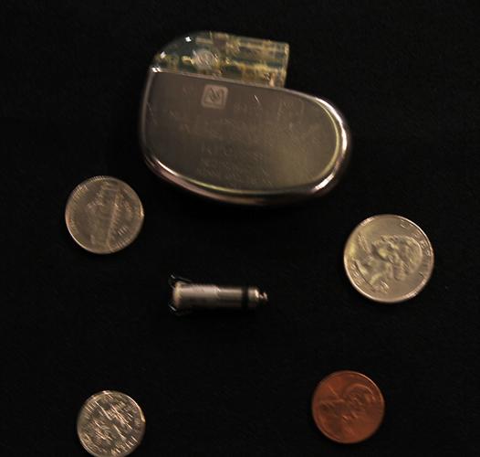 World's smallest pacemaker implanted in OKC man at OU Medical Center ...