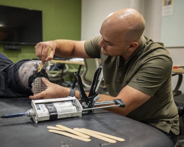 Spartanburg man gets prosthetic leg after newspaper story