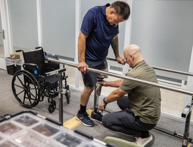 Spartanburg man gets prosthetic leg after newspaper story