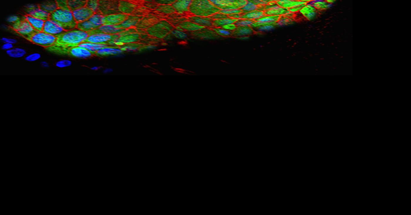 Model aims to tell researchers how infection passes placenta | Features ...