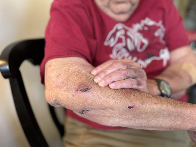 Joseph Floyd Manor resident charged in on-site assaults, sparks safety ...