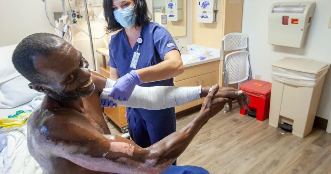 Newly reopened MUSC burn center performs nation's first new type of no ...