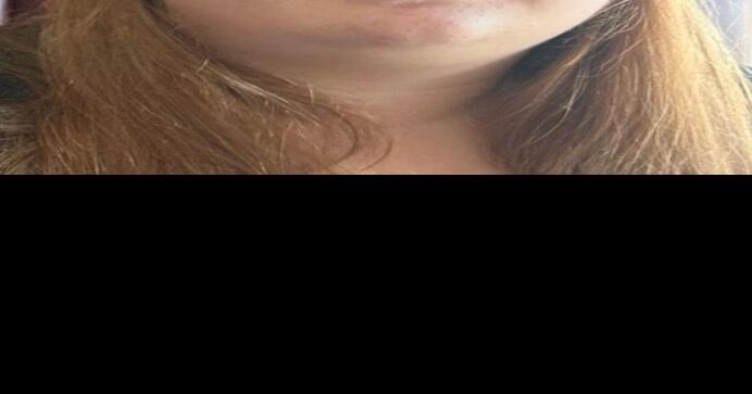 Police look for Aiken County teen with epilepsy; listed as runaway ...