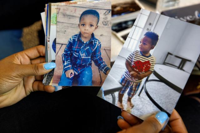 Toddler dies after undergoing general anesthesia for dental surgery ...