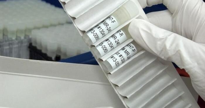 Bird flu test scarcity could limit detecting spread