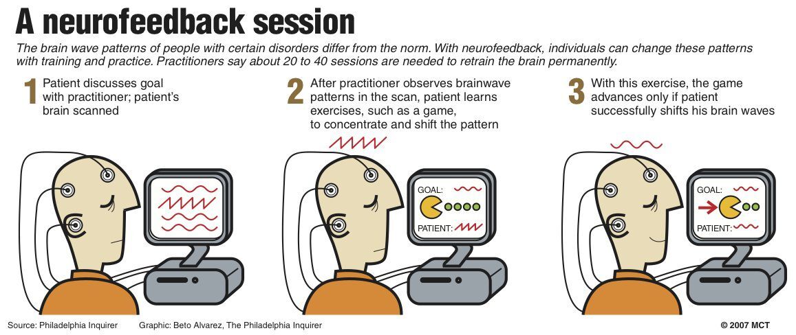 'I feel more like myself:' Neurofeedback uses brain waves to help ...