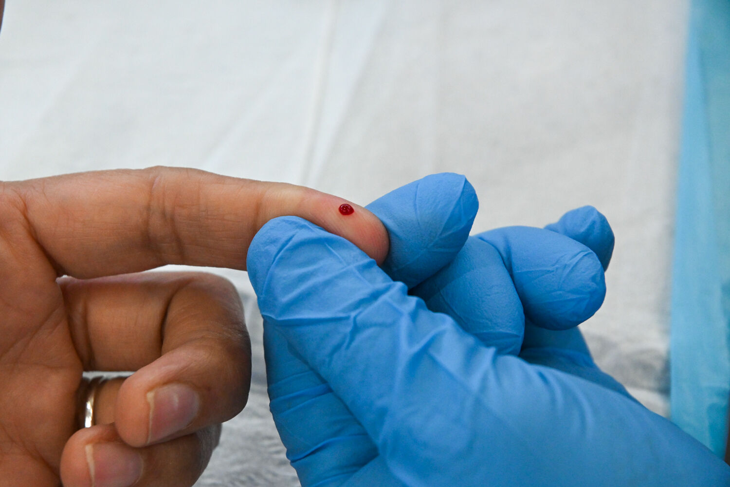 Visiting specialists provide care to patients suffering from Bleeding ...