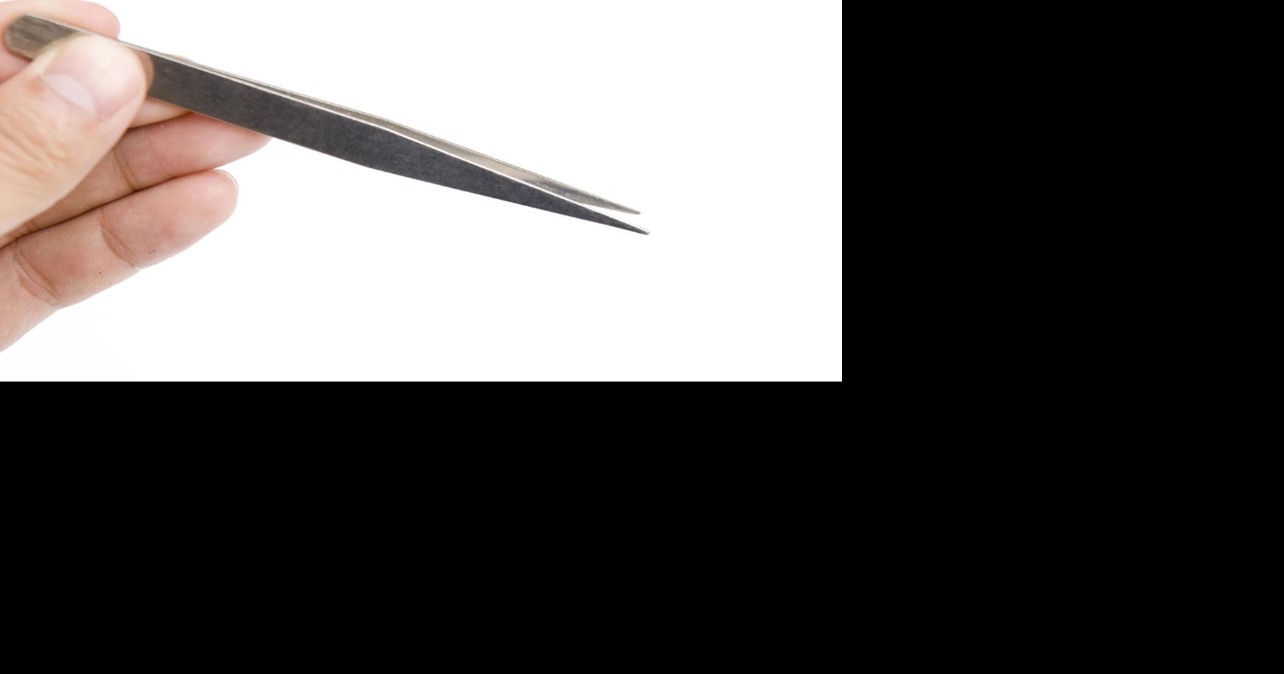 Removing a splinter? Treating a wart? If a doctor does it, it can be ...