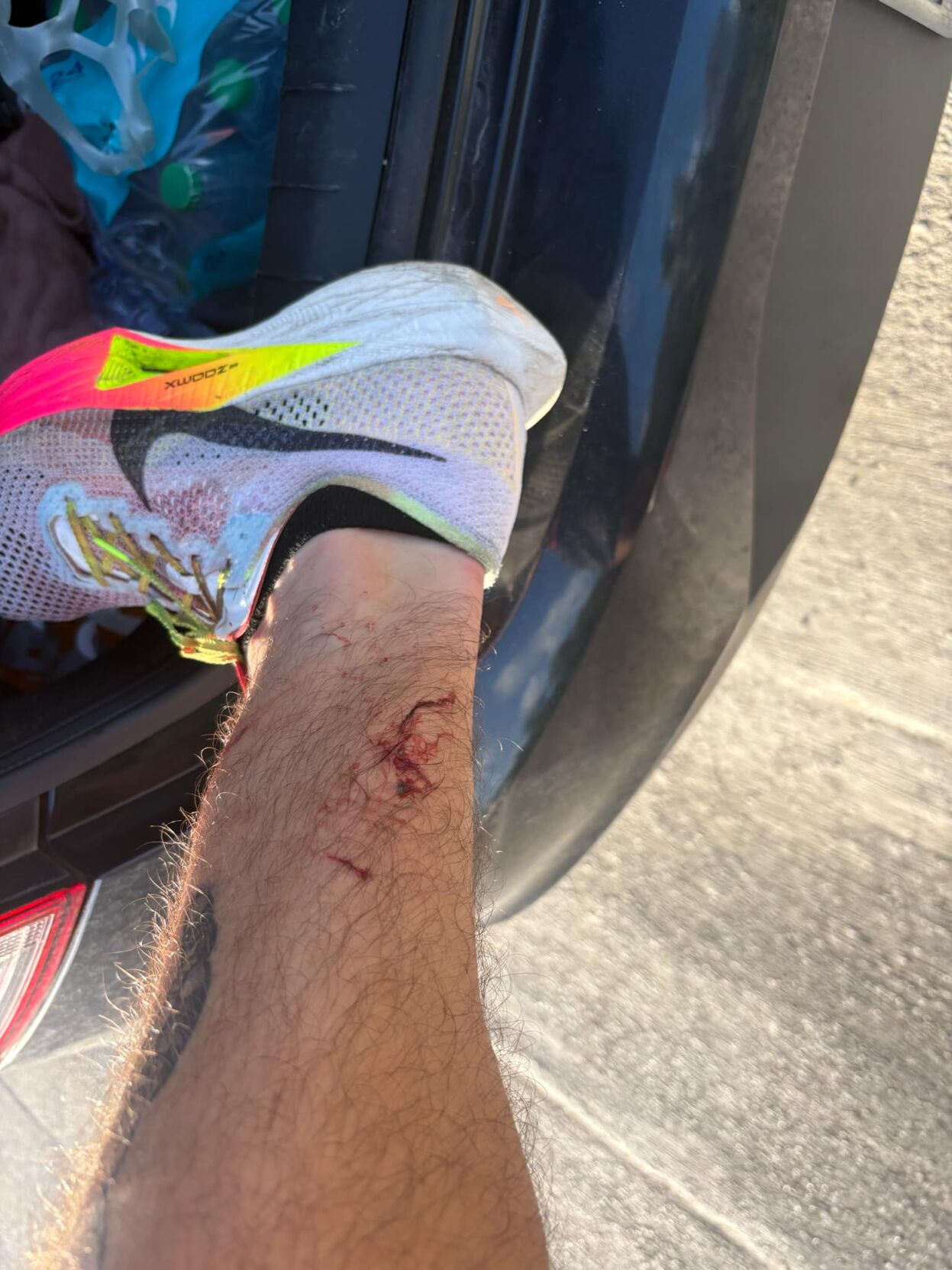 David Perry attacked by dogs, but finished the race | Local Sports ...