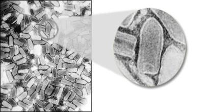 rabies under a microscope