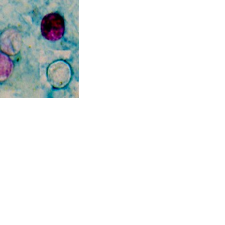 NOVA health departments warn of bug causing intestinal distress | News ...