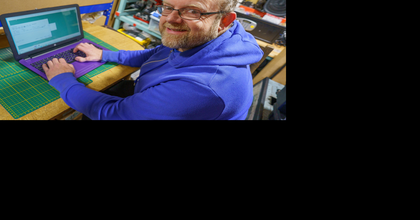 Cobbler who accidentally cut off thumb gets it replaced with his big ...