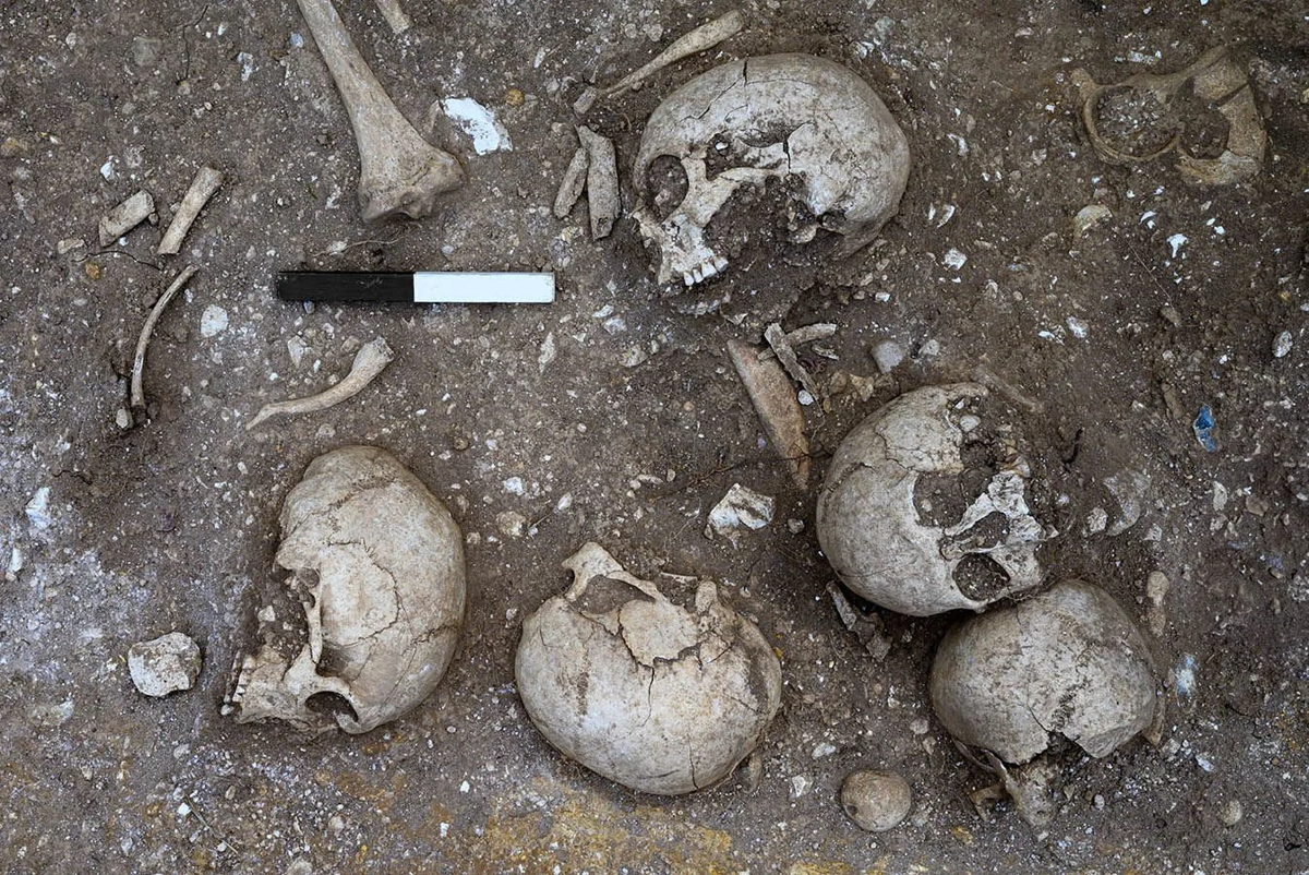 Viking-era skull gives glimpse of world’s first brain surgery ...