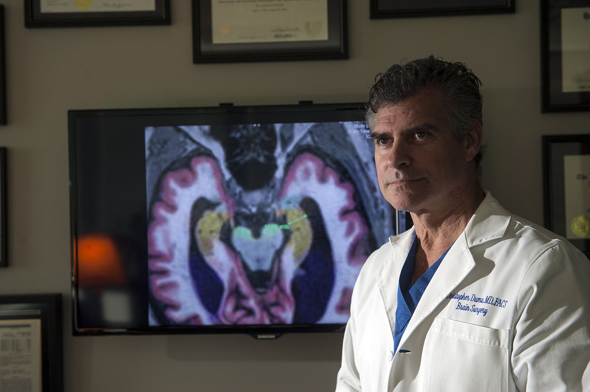 Is Alzheimer's treatment of injecting stem cells into the brain a ...