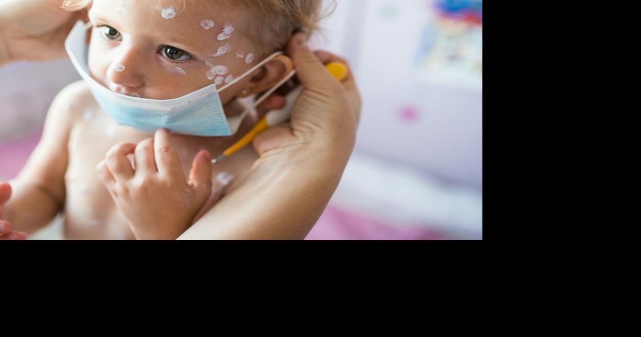 Grant County sees surge in chickenpox and whooping cough cases | Local ...