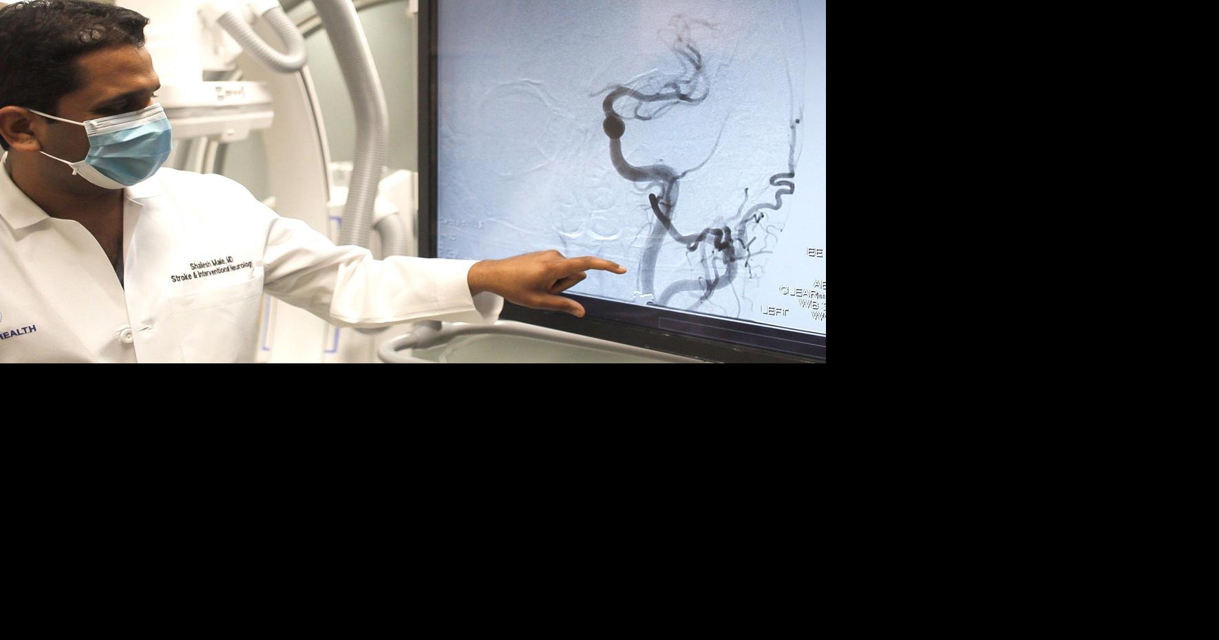 Highlighting Your Health: Experts seeing more strokes, greater risk in ...