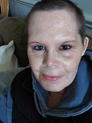 We fall to rise again | | reflector.com