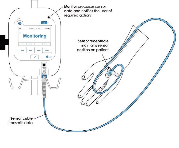 Williamsburg firm to market IV monitoring device | Business News ...