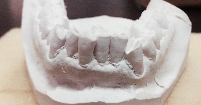 Bite mark analysis, other forensic techniques under review