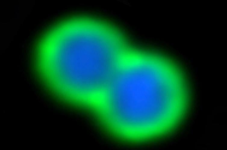 How human antibodies could help defeat superbugs | Health ...