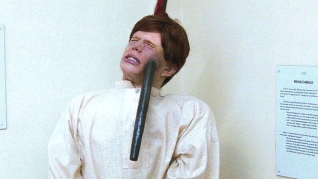 “Meet” Phineas Gage at the Saint Albans Museum | Local News ...