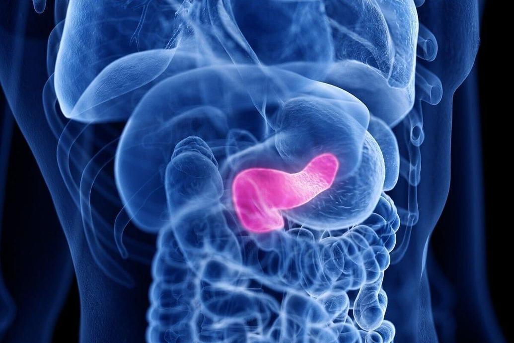 Risk Score Helps Predict Pancreatic Cancer Recurrence, Study Says ...