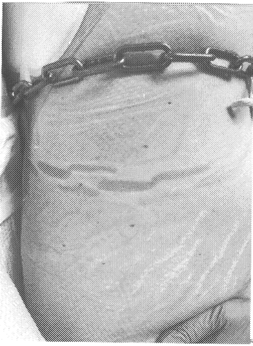 Lawsuit calls Santa Fe jail's shackling of hospitalized inmate cruel ...