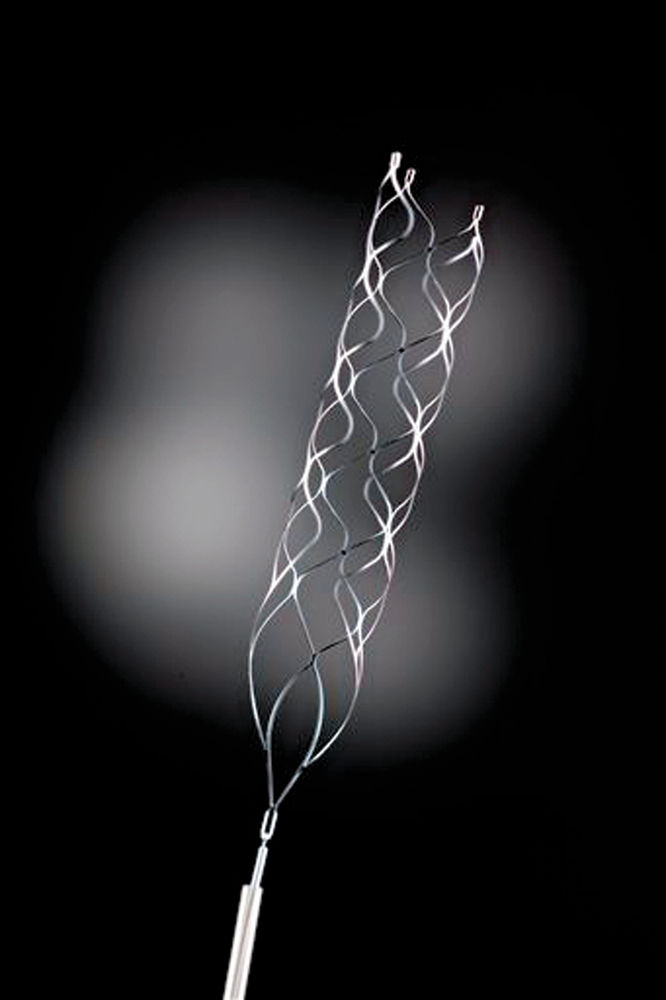 Brain stents show big promise for certain stroke patients | Health And ...