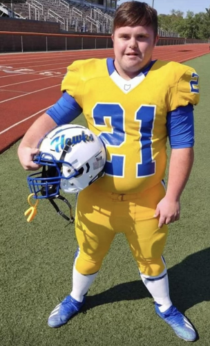 Cox turns disability into limitless possibility | Acbdd | sjnm360.com