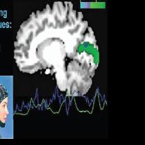 Brain scans let computer reconstruct movie scenes | Lifestyle ...
