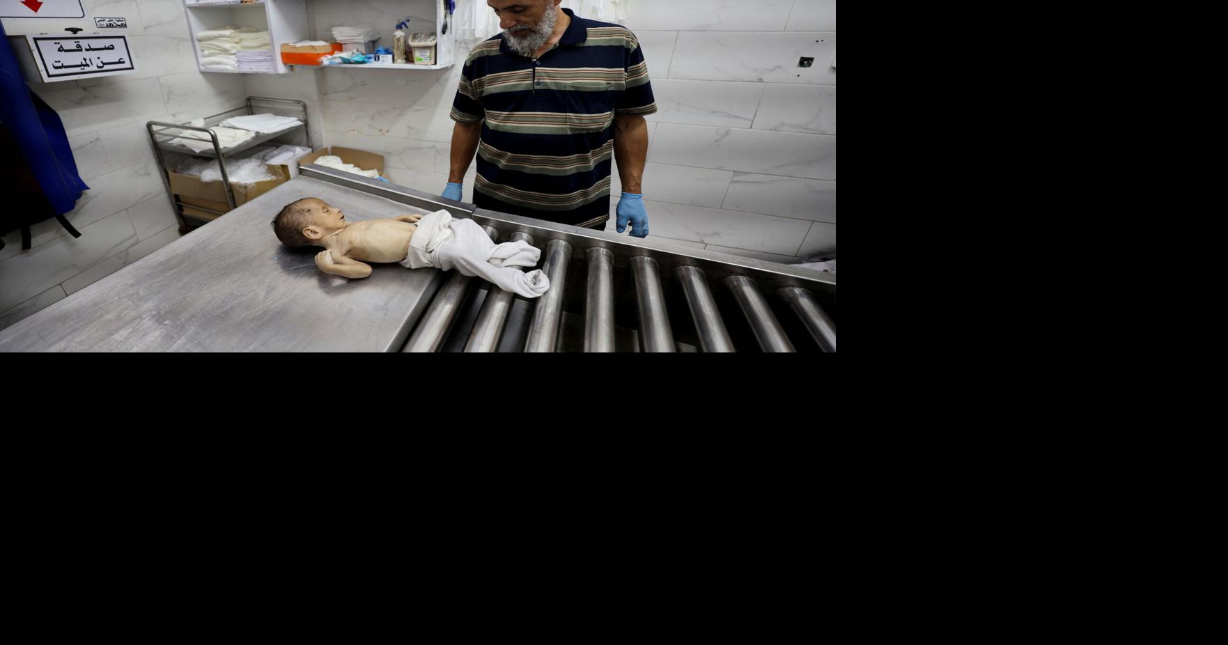5 children starved to death at a Gaza hospital and emaciated kids are ...