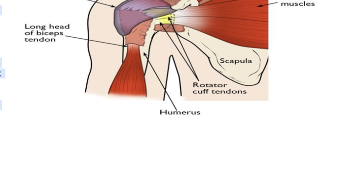 Shoulder pain: rotator cuff tear vs rotator cuff tendinitis | Opinion ...