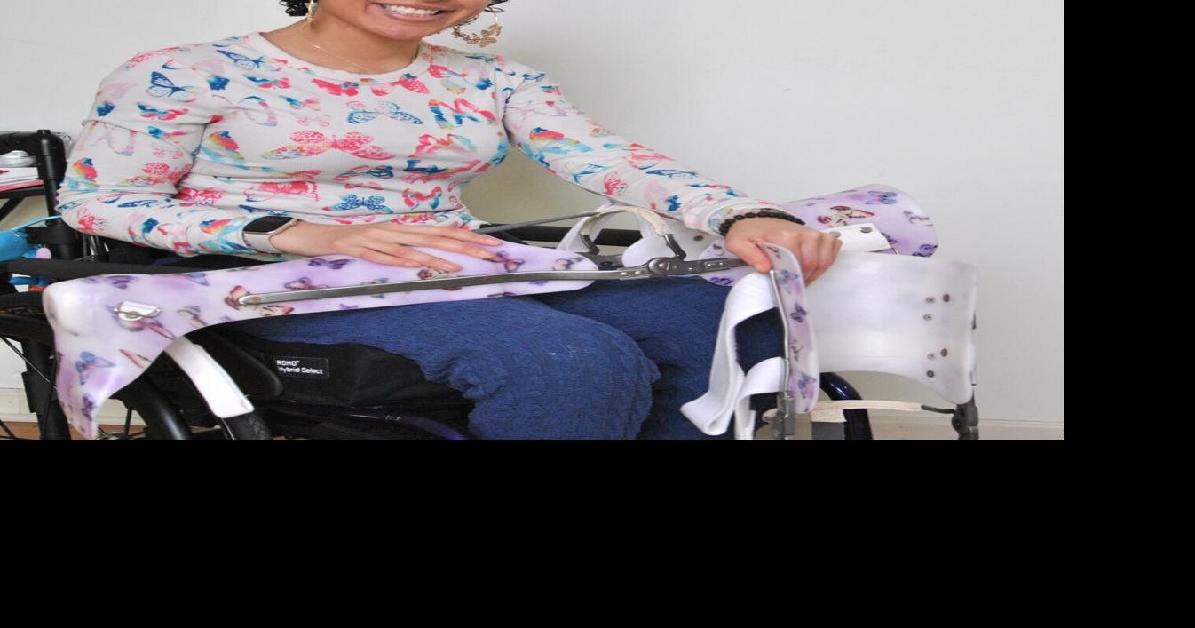 Gunshot survivor learning to walk again, speaking out | News ...
