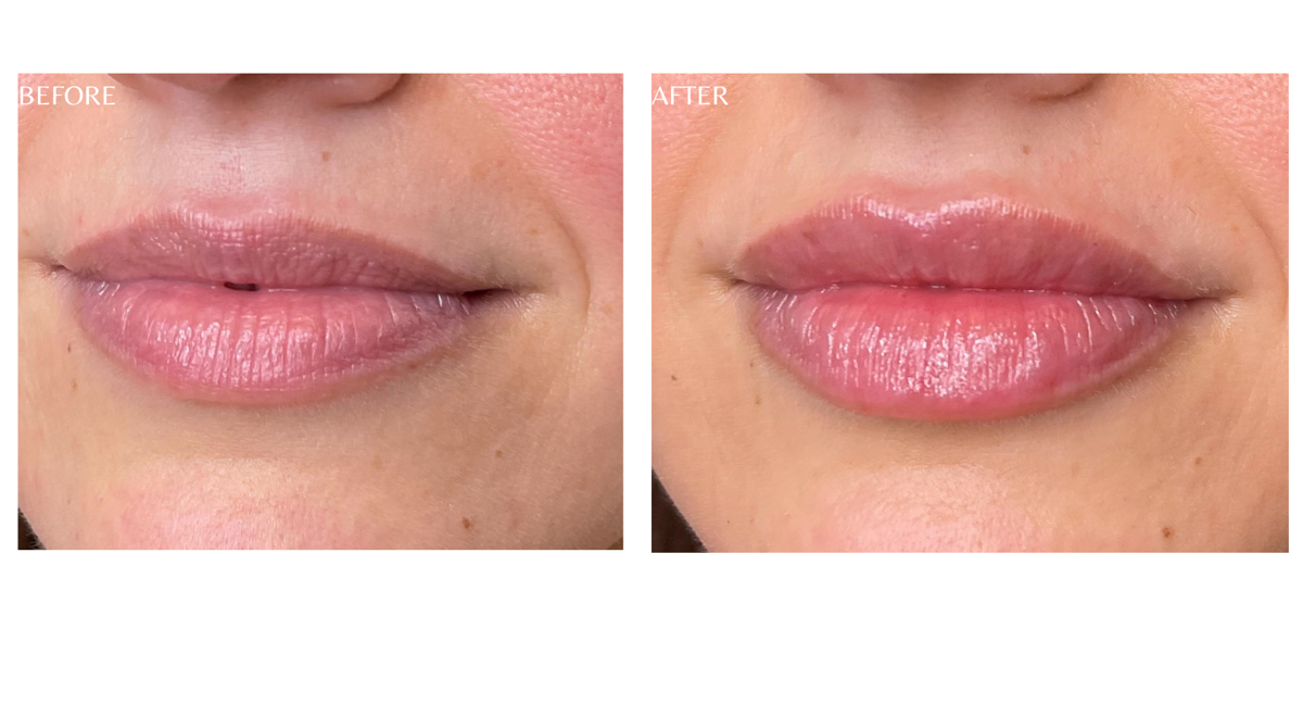 What Does It Mean When Babies Pucker Their Lips | Lipstutorial.org