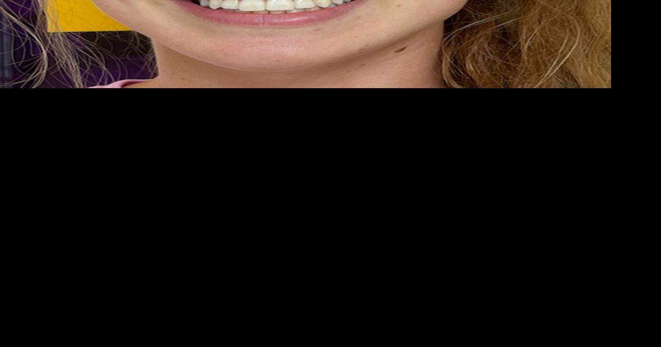 Madison Scheer, senior, Eureka