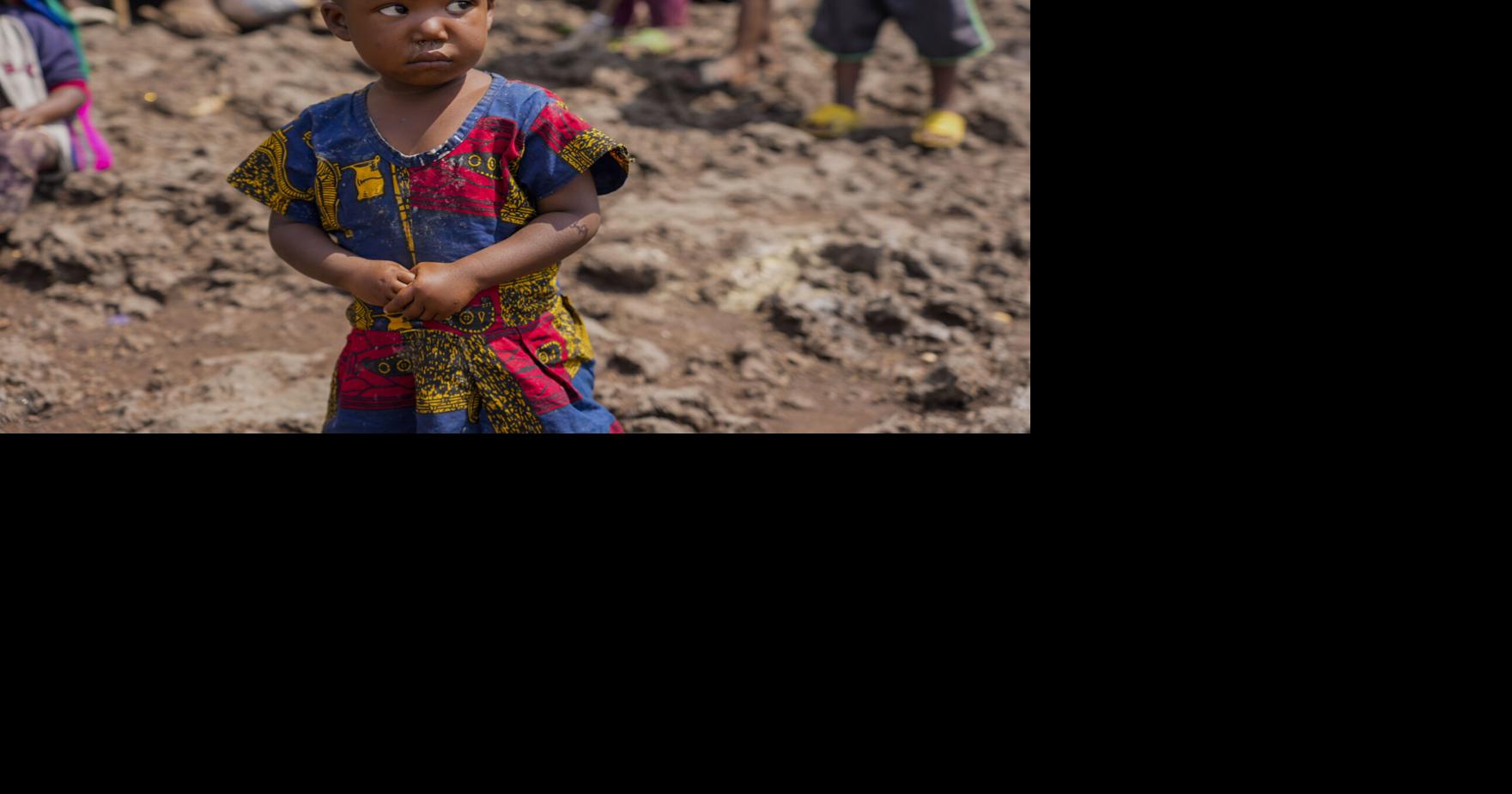 Rebel violence in eastern Congo causes hunger to soar