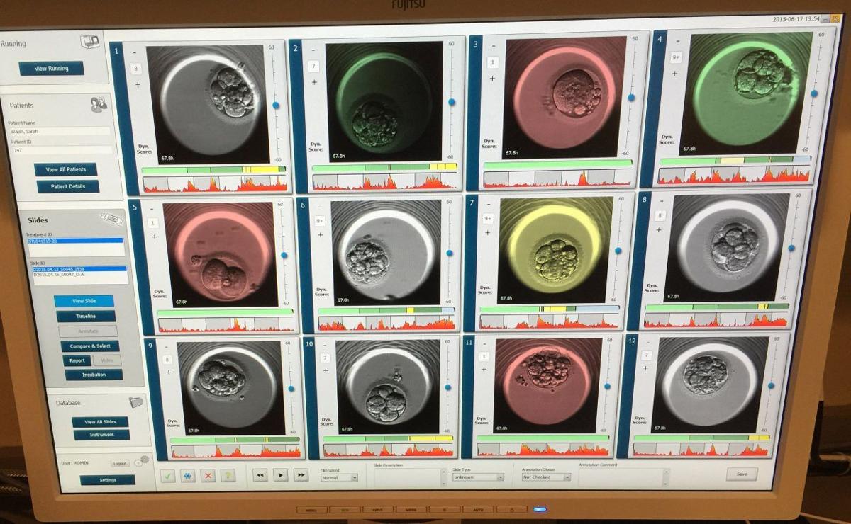 Infertile couples hope new technology helps select most successful embryos