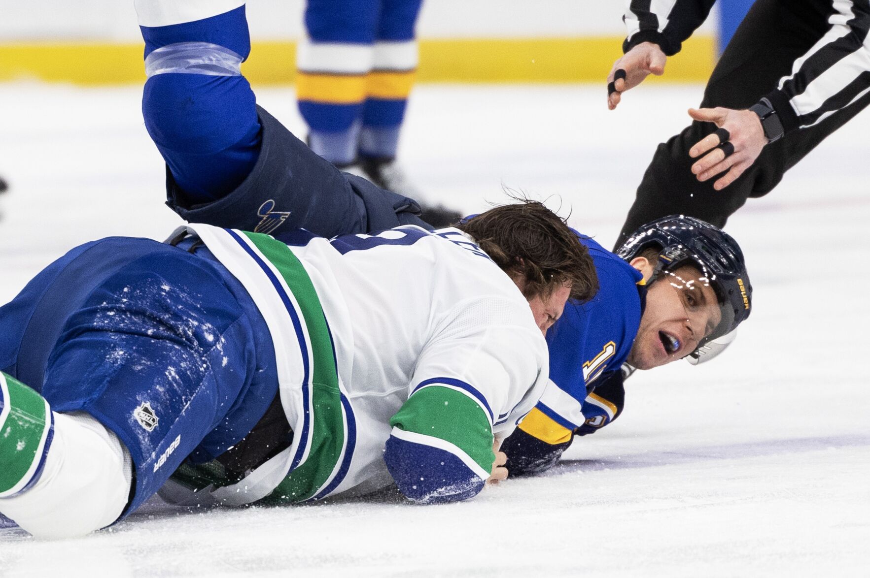 Loss to Canucks another step backward for Blues