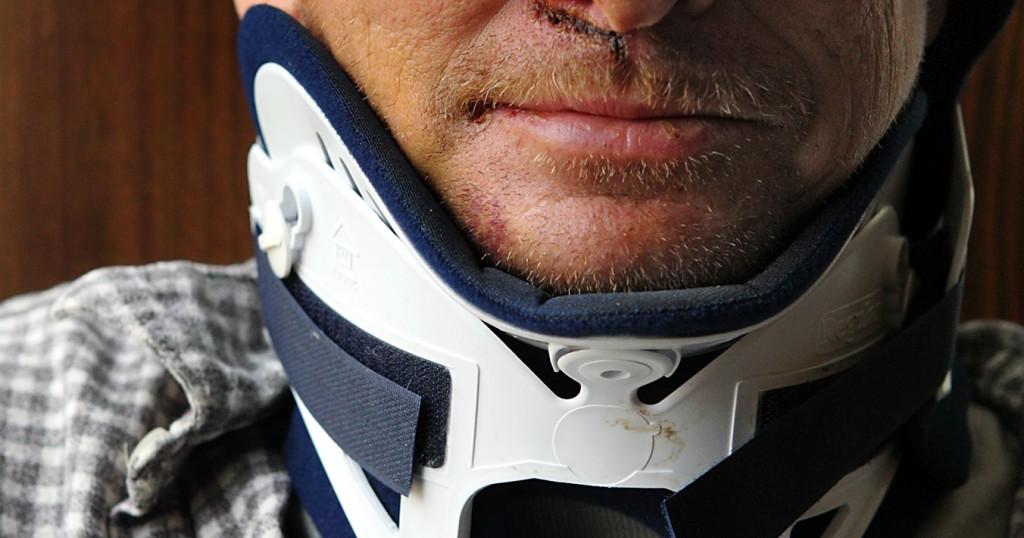 St. Louis 'knockout game' case dismissed after witness misses court