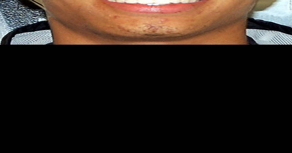 Aaron Mallett, sr., McCluer North