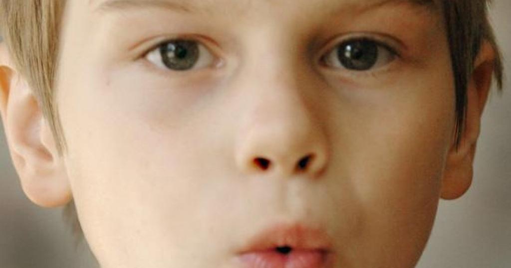 Whistling makes Robby Hood a confident boy