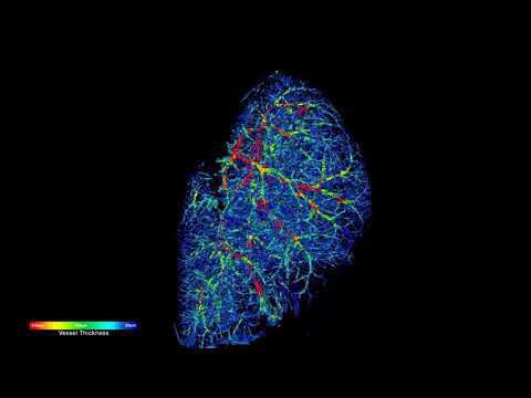 Washington University researchers win award for mouse lung video