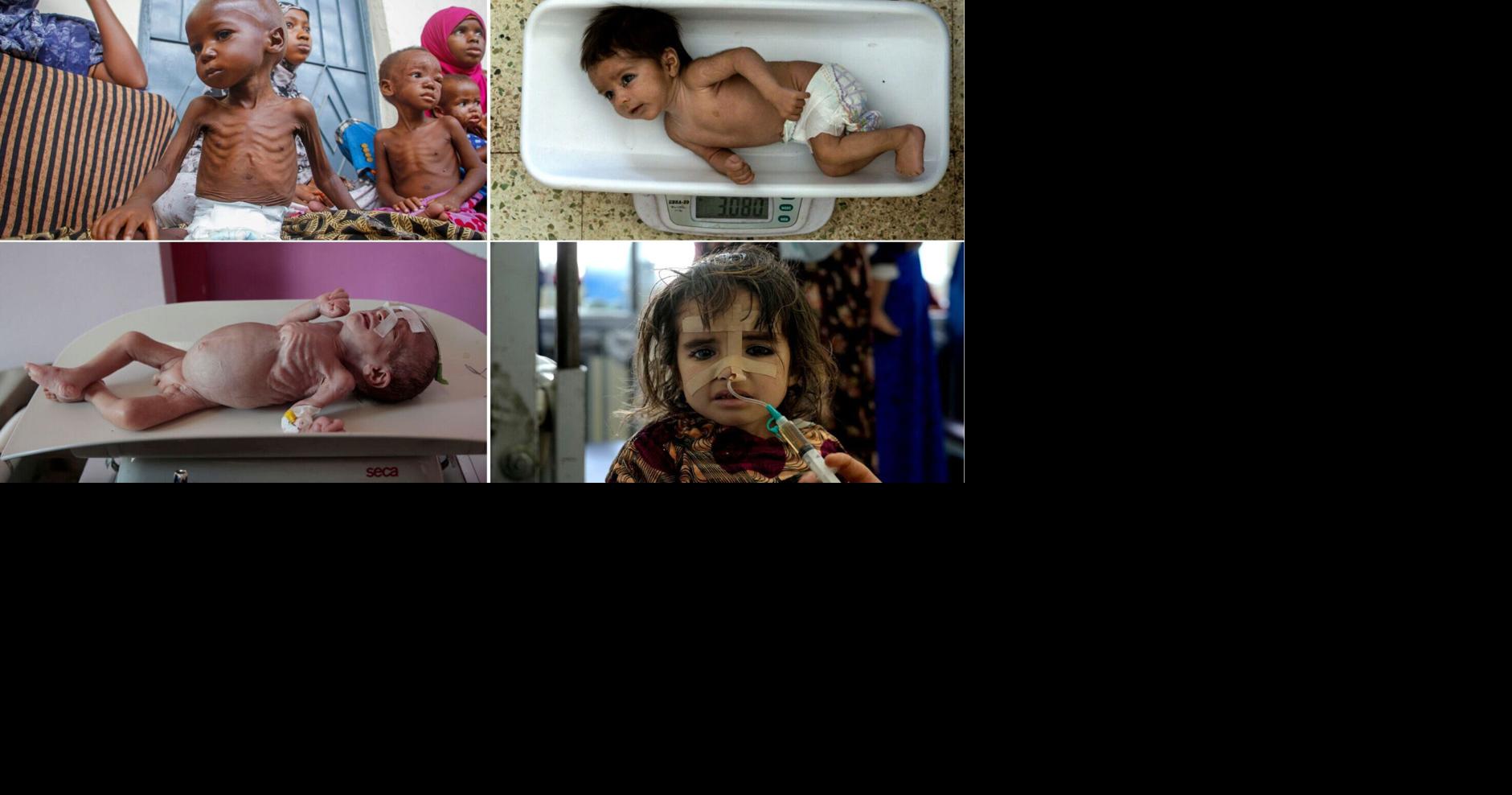 UN food chief urges immediate action to prevent famine