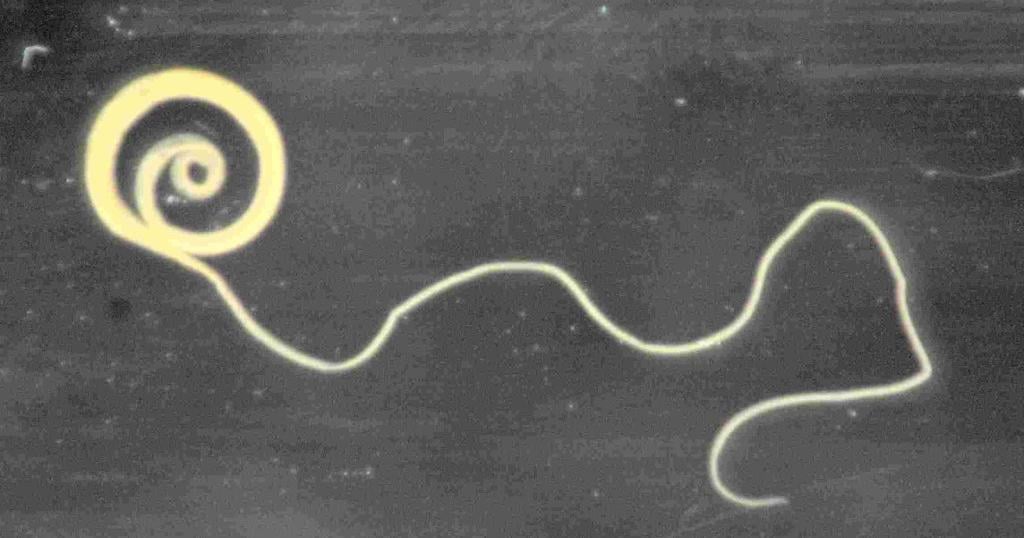 Pig whipworms might be latest icky treatment for gut conditions