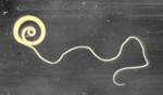 Pig whipworms might be latest icky treatment for gut conditions