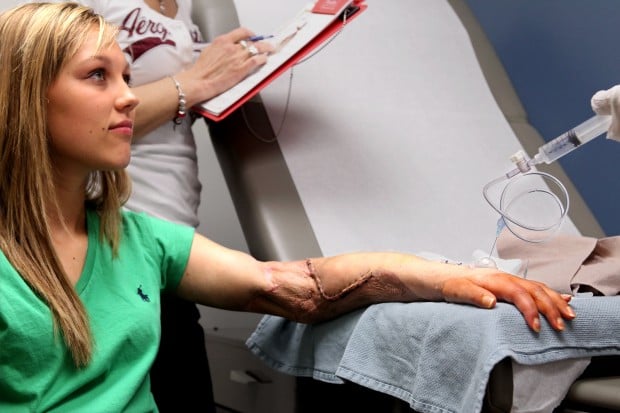 Recovering from a severed arm : Gallery