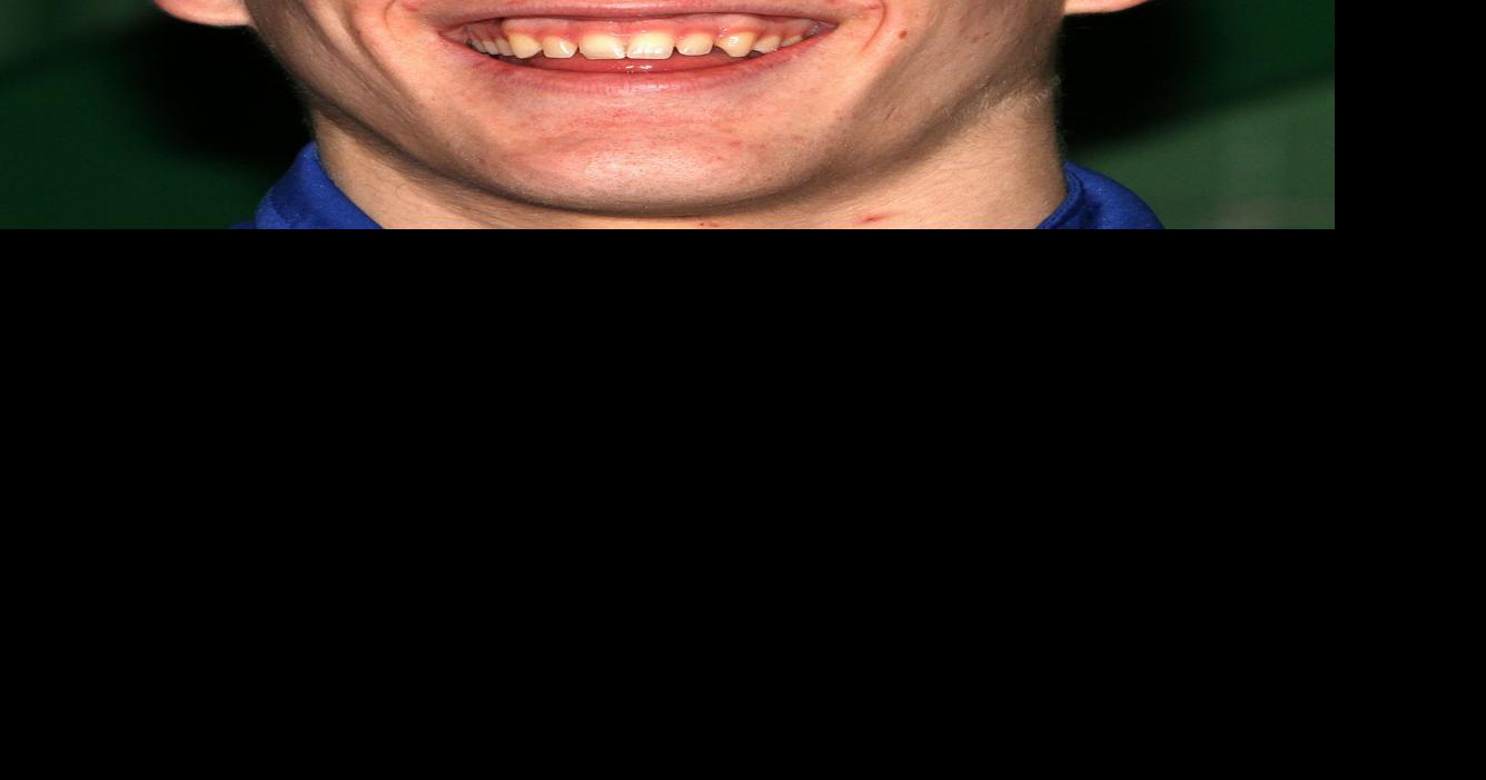 Luke DeLine • Borgia basketball