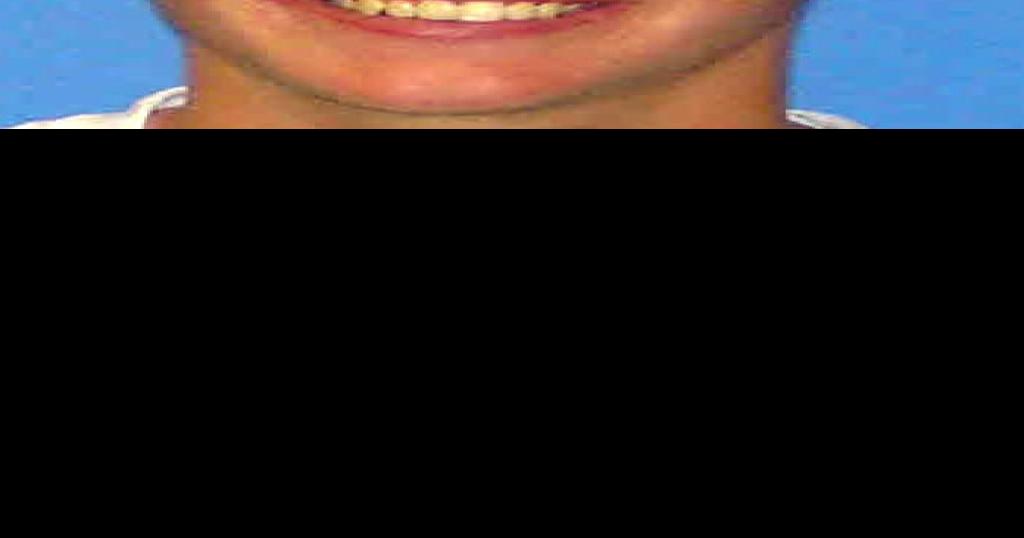 Alex Riba, sr., O'Fallon