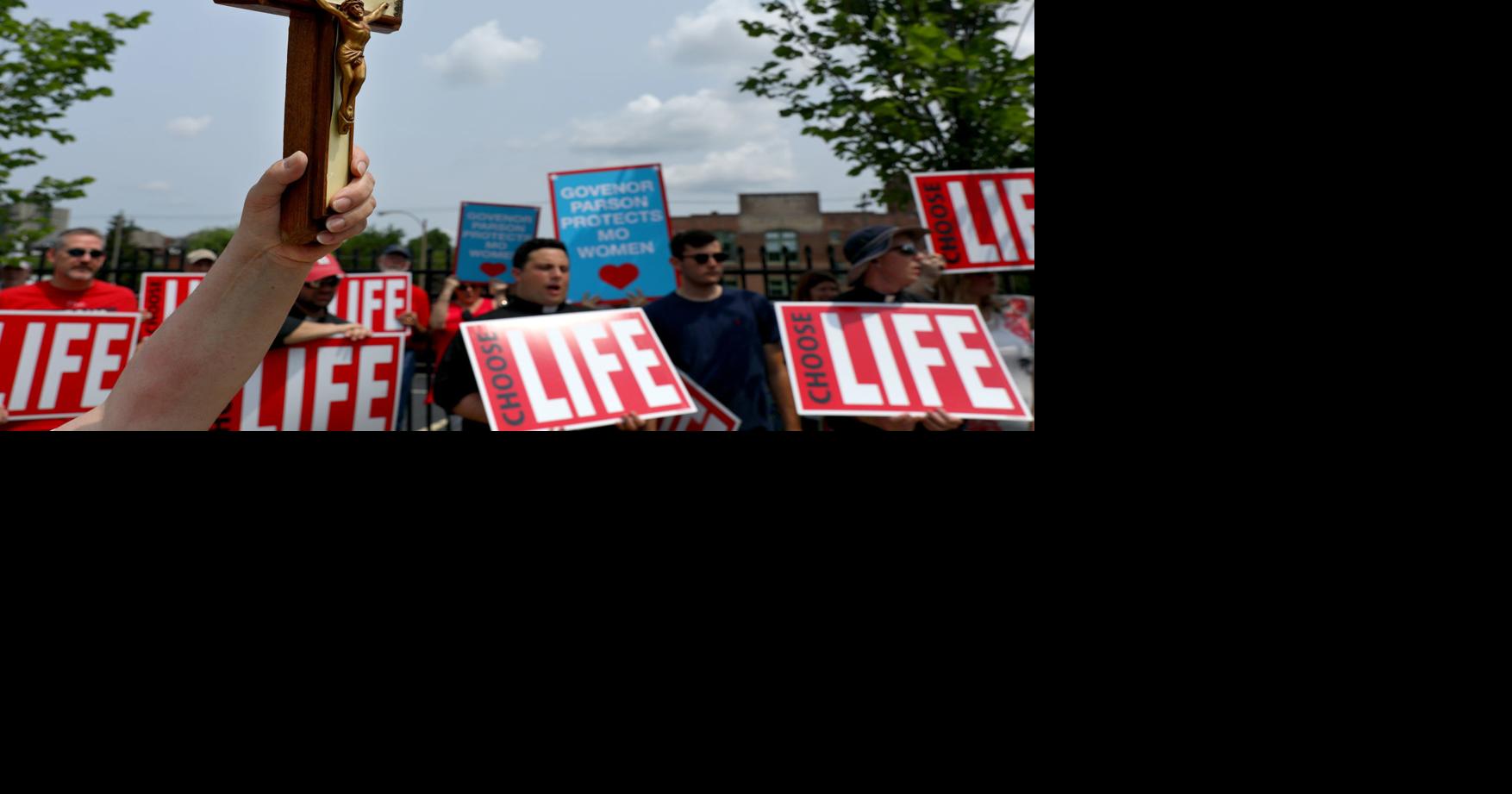 Life begins at conception is not just a religious belief