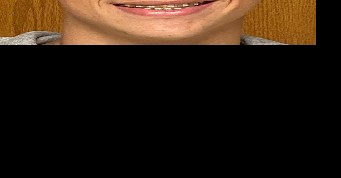 Colton Kossuth • Pacific football